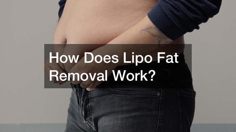 How Does Lipo Fat Removal Work? - Greg's Health Journal